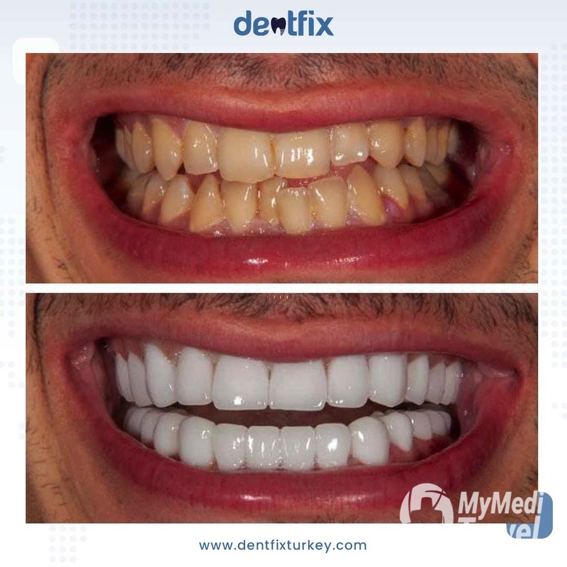 Dentfix Turkey - Medical Center in Istanbul | MyMediTravel