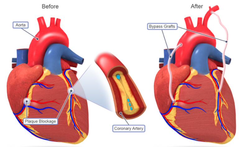 10 Best Clinics for Coronary Artery Bypass Graft (CABG) Surgery in Al Khan [2023 Prices]